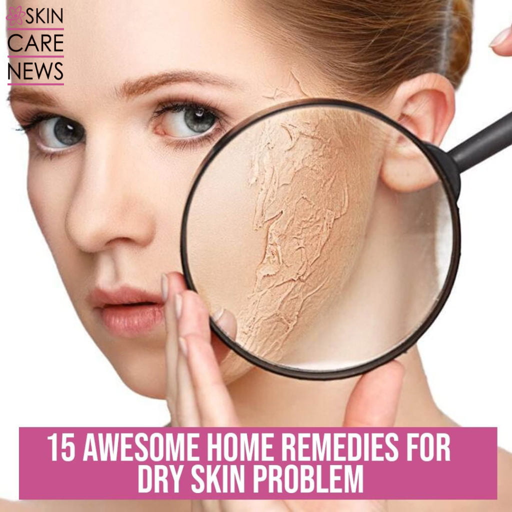 15 Awesome Home Remedies For Dry Skin Problem - Skin Care Top News
