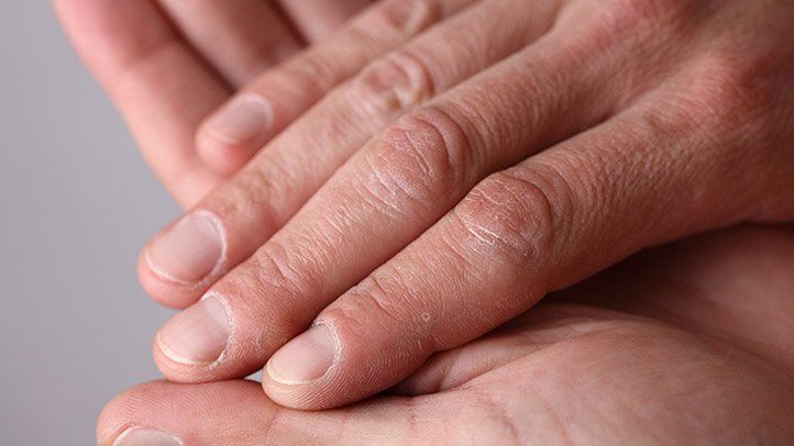 What Your Nails Say About Your Health - Skin Care Top News