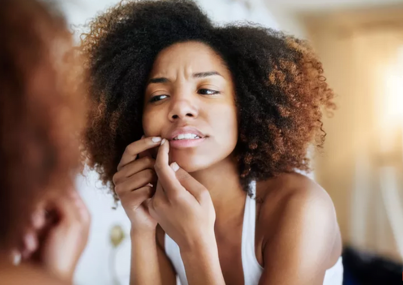 Causes Of Acne Scars And How To Prevent Them Skin Care Top News