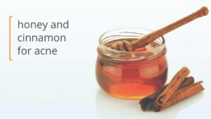 Honey and Cinnamon Face Mask Recipe and benefits