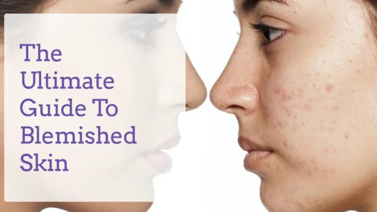 The Ultimate Guide To Blemished Skin - Skin Care Top News