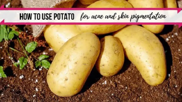 Potato For Acne, Dark Spots And Pigmentation: Skin Care Top News