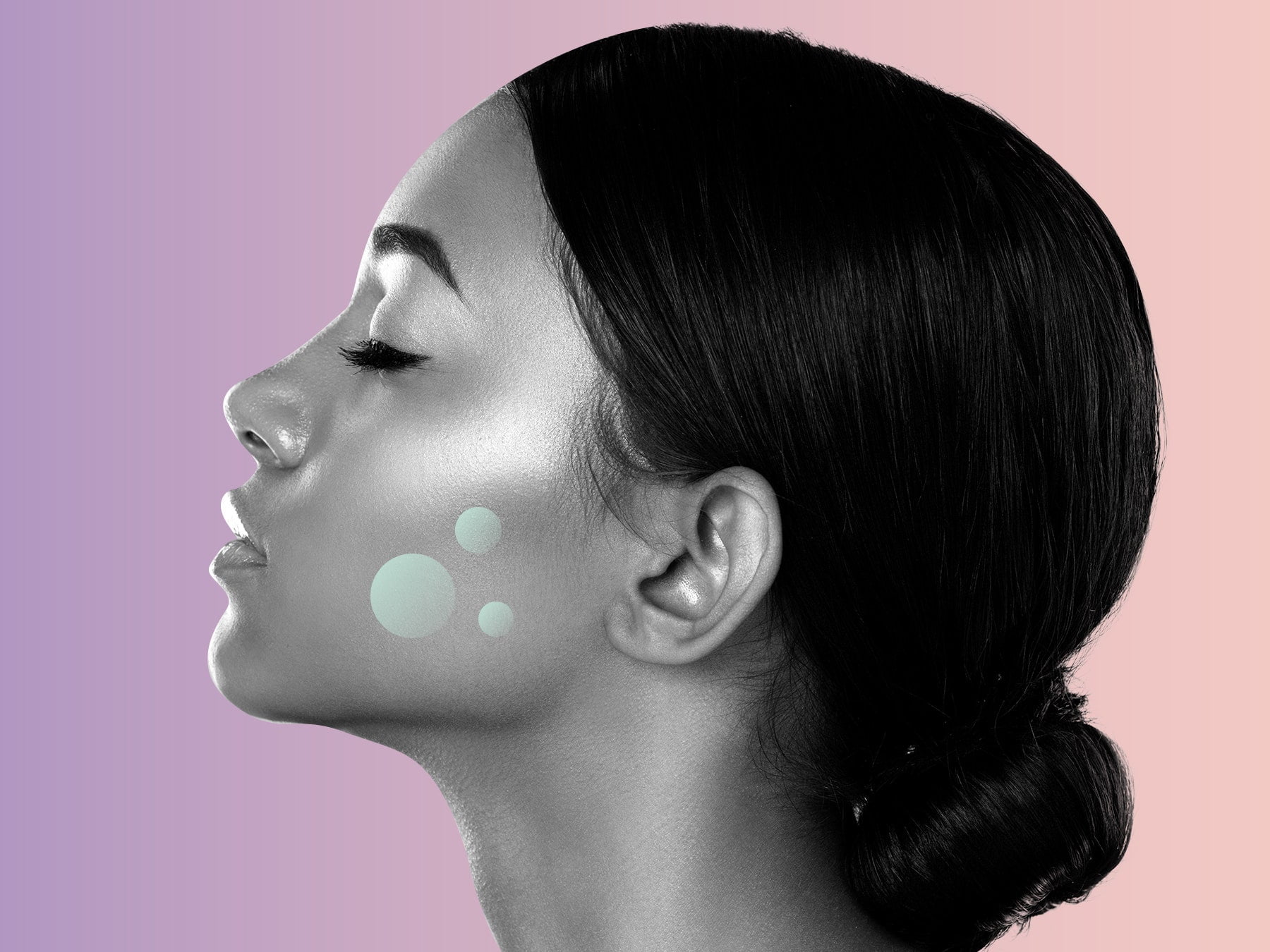 Hyperpigmentation – What causes dark spots and how can I reduce them?