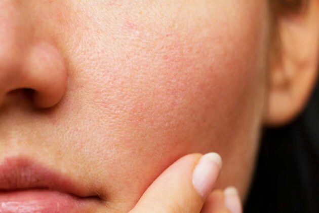 6 Ways to Deep Clean for unclogging Your Pores at Home