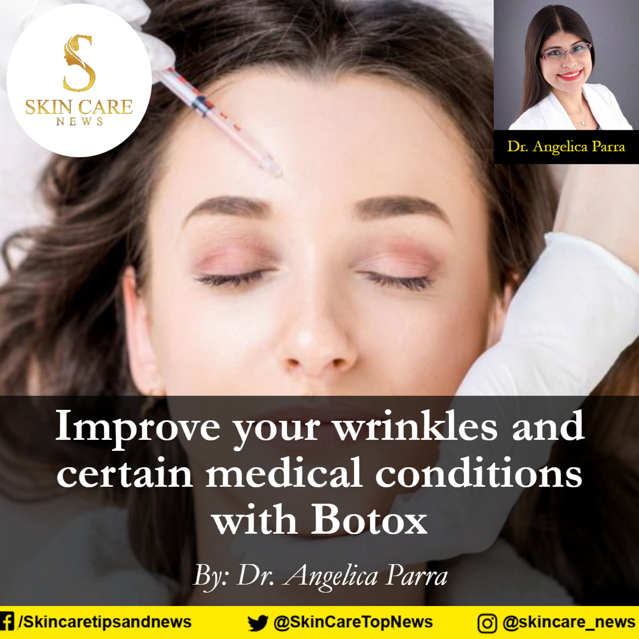Improve your wrinkles and certain medical conditions with Botox