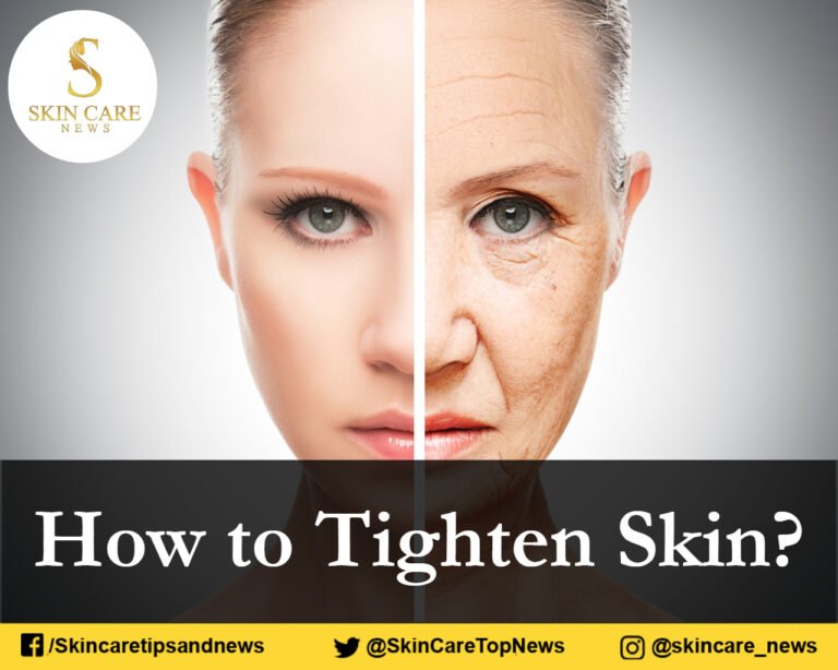 Natural Home Remedies to Make your Skin Tighten