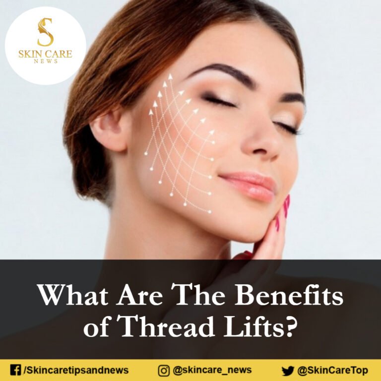 What Are The Benefits of Thread Lifts?