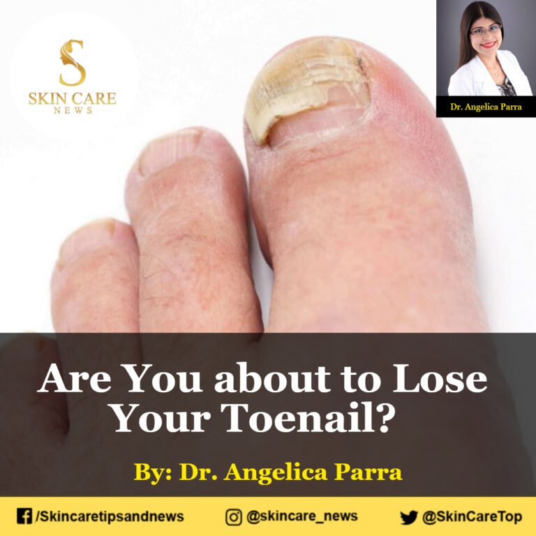 Are You about to Lose Your Toenail? Are You about to Lose Your Toenail?