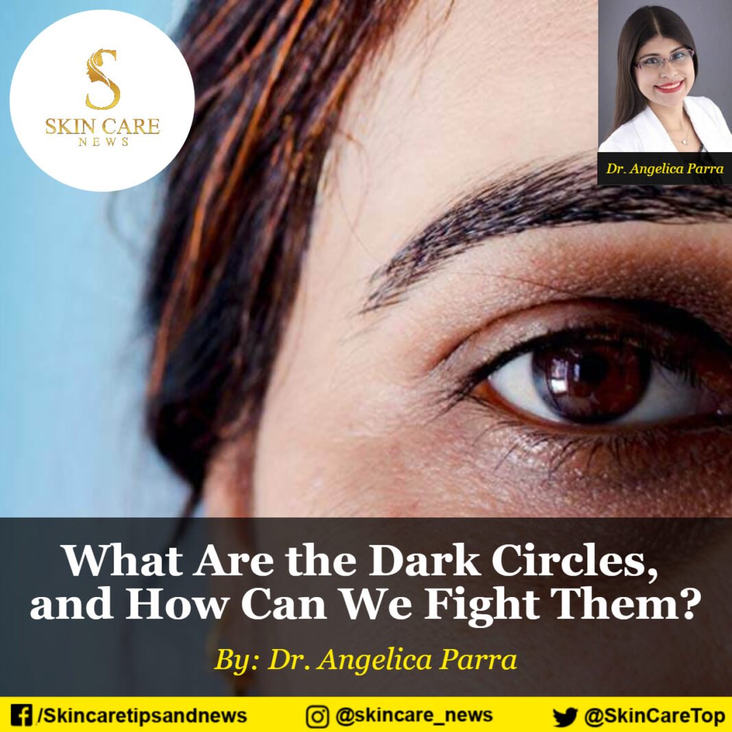 What Are the Dark Circles, and How Can We Fight Them?