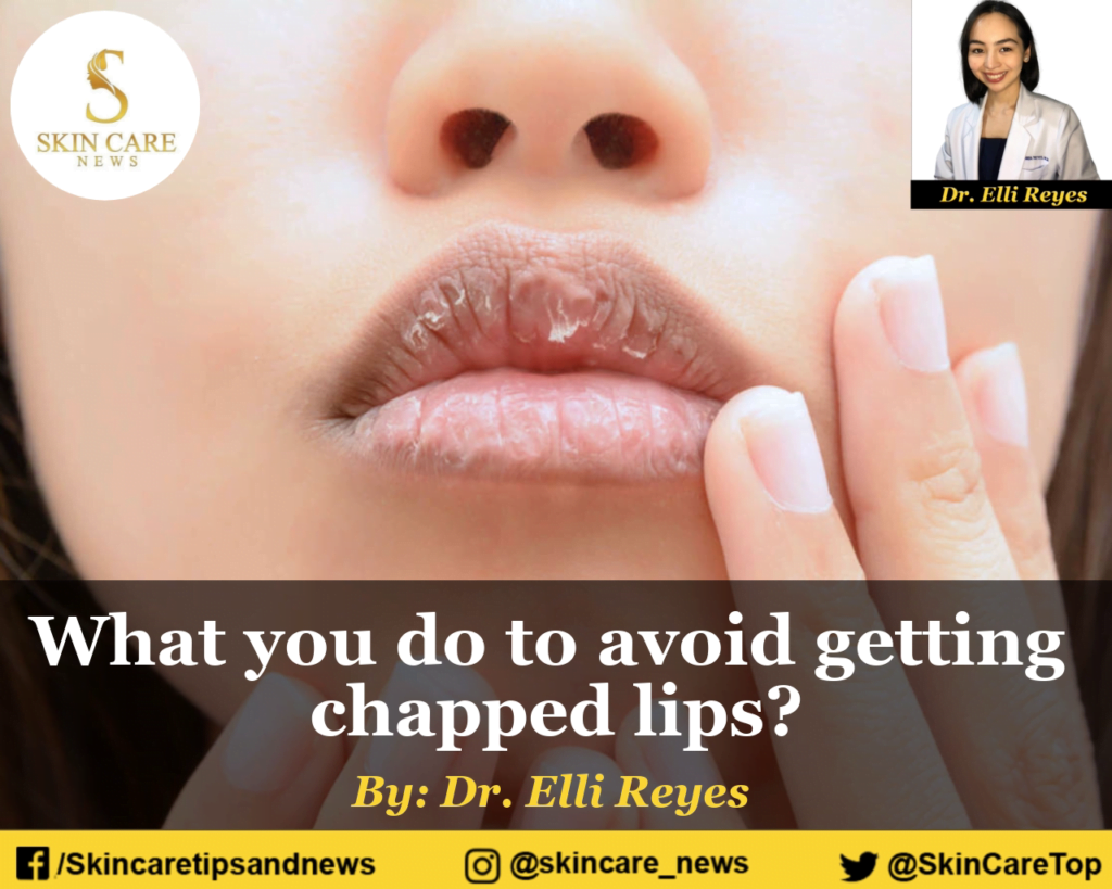 What You Do to Avoid Getting Dry and Chapped Lips?