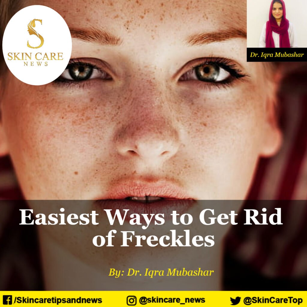 Easiest Ways to Get Rid of Freckles -- Skincare News--