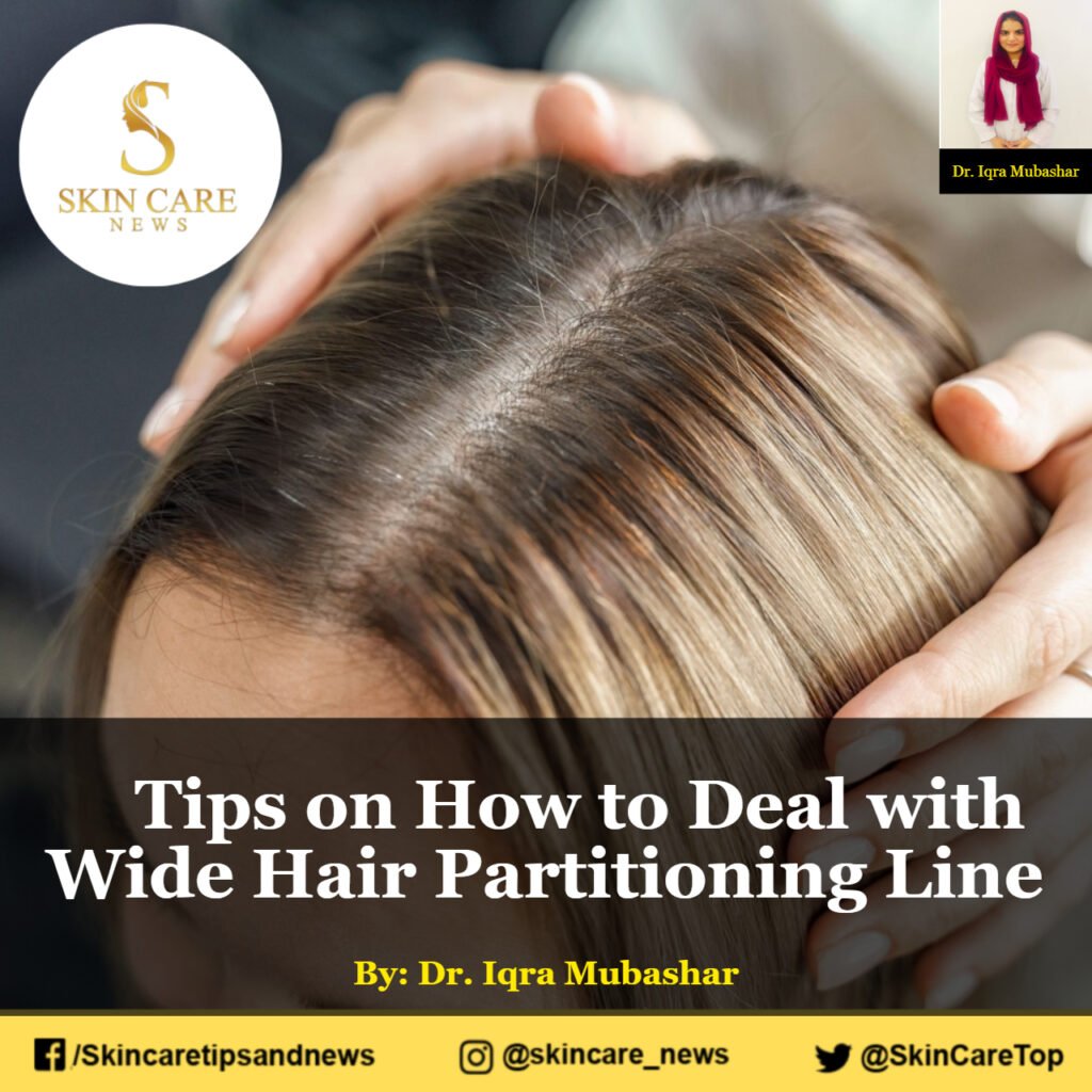 Tips on How to Deal with Wide Hair Partitioning Line