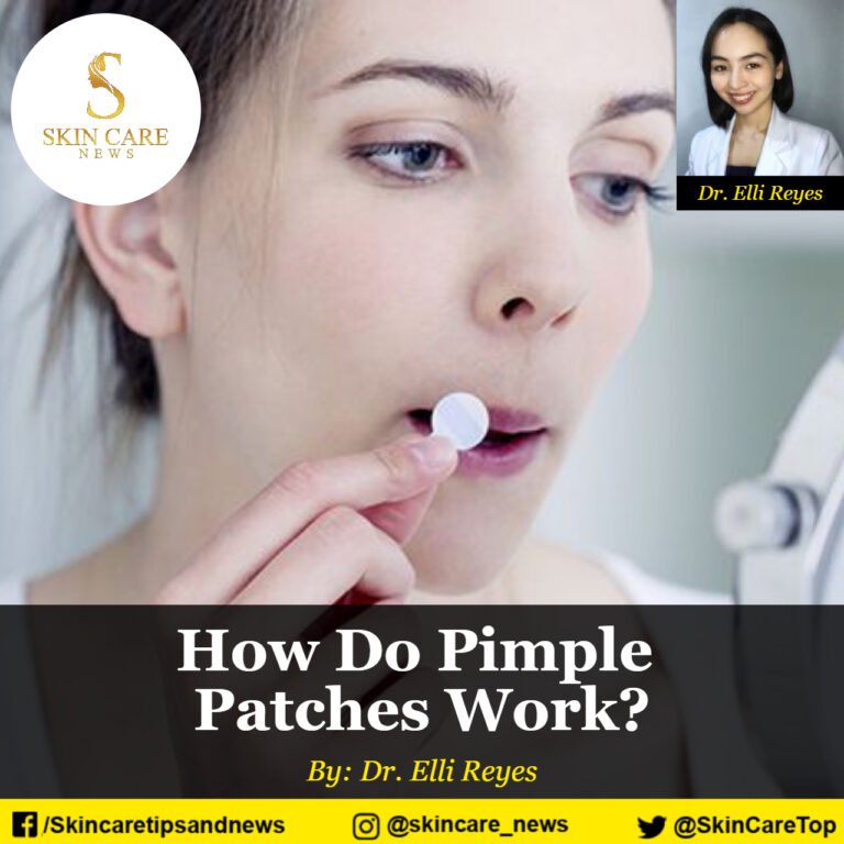 How Do Pimple Patches Work? - Skincare Top News