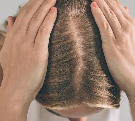 Tips on How to Deal with Wide Hair Partitioning Line