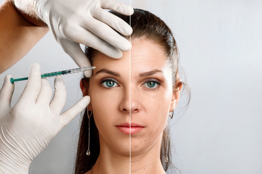 Botox How Does It Work And How Long Will It Last botox-how-does-it-work-and-how-long-will-it-last