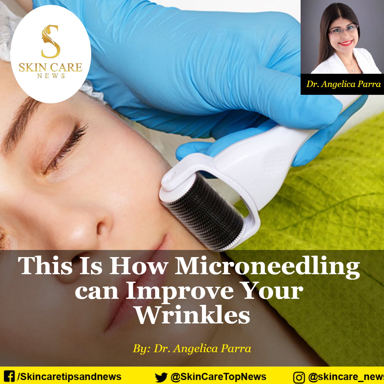 This Is How Microneedling can Improve Your Wrinkles