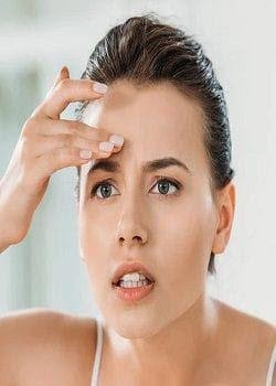 Why Do We Get Acne Between Our Eyebrows?