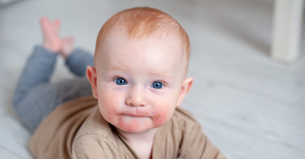 Teething Rash: Can Teething Actually Cause a Rash?