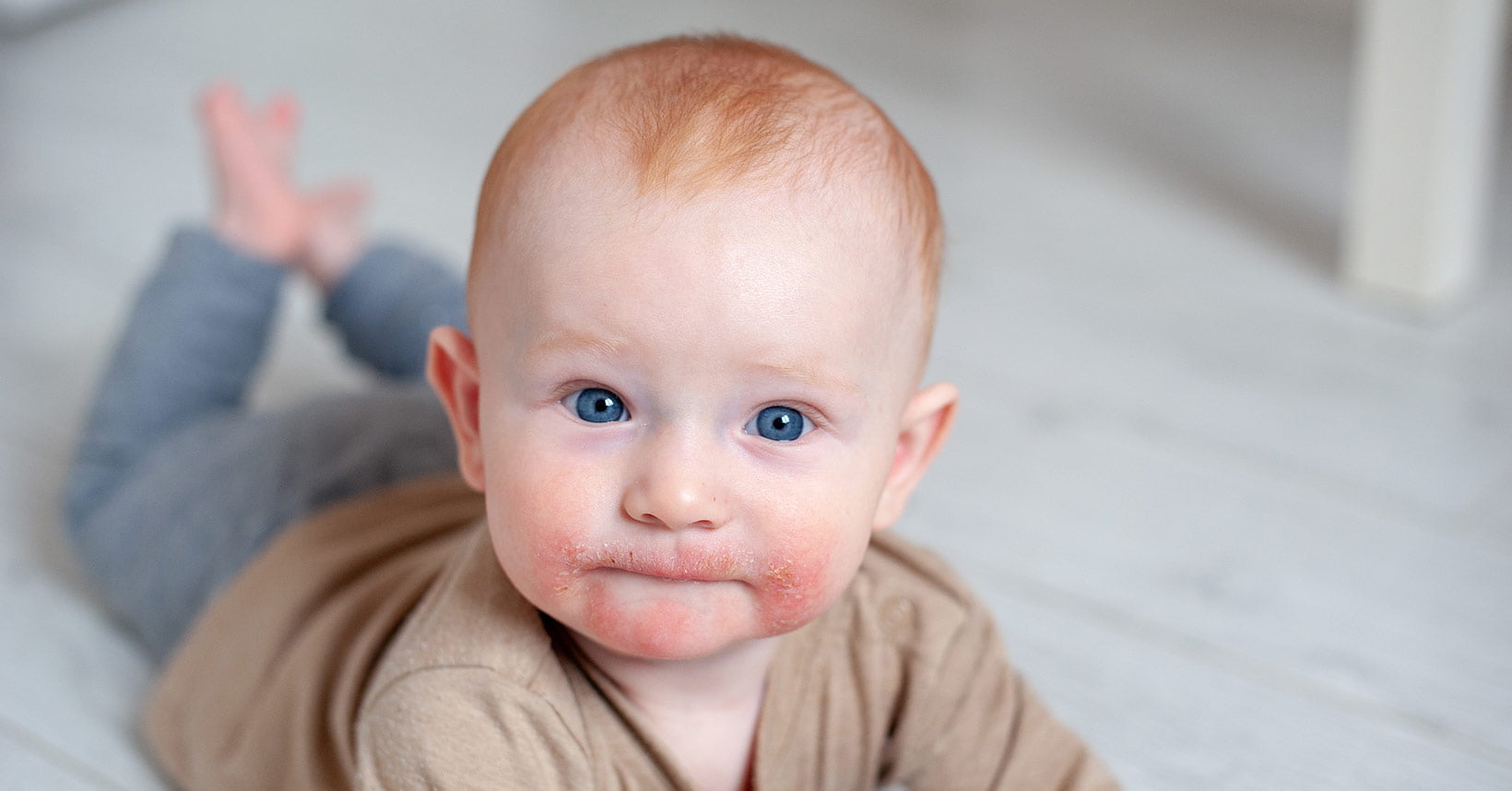 Teething Rash: Can Teething Actually Cause a Rash?