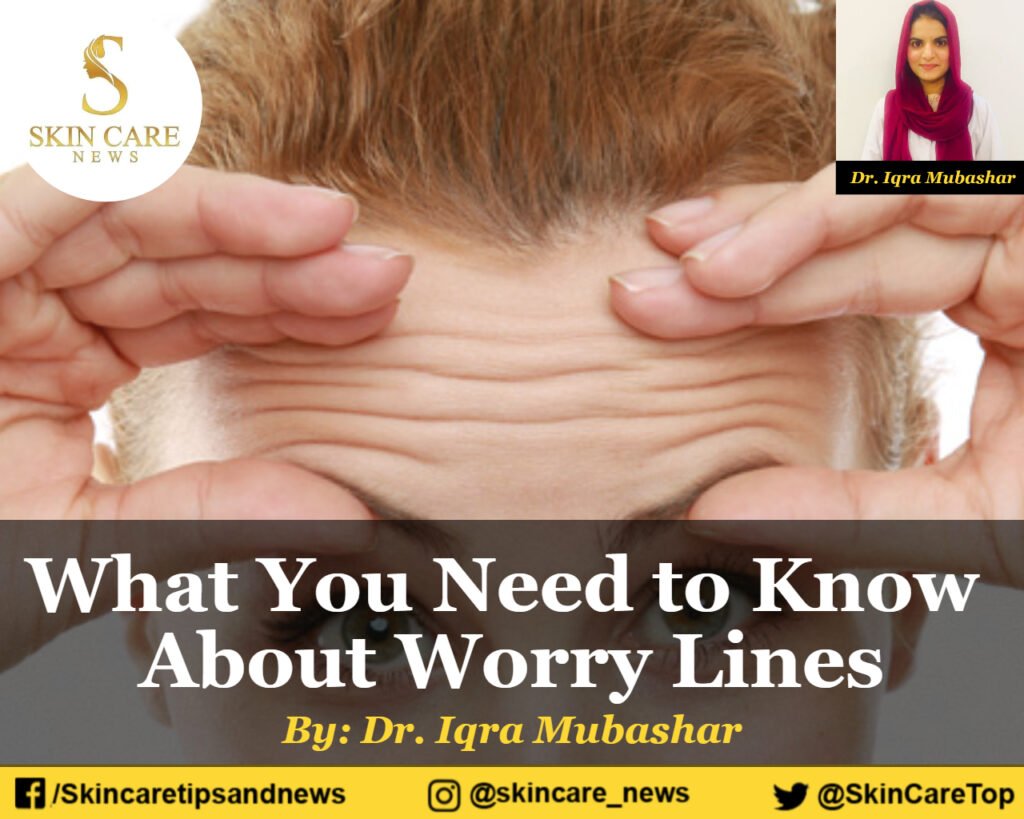 What You Need to Know About Worry Lines