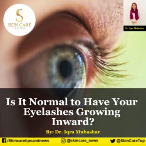 Is It Normal to Have Your Eyelashes Growing Inward?