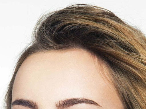 How to Deal with A Cowlick in Your Hair?
