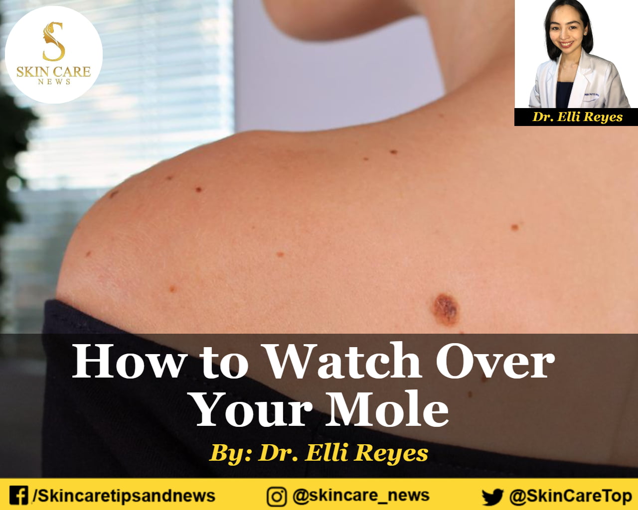 How to Watch Over Your Moles