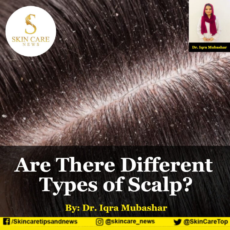 Are There Different Types of Scalp?