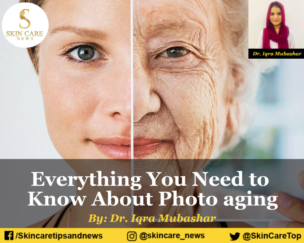 Everything You Need to Know About Photo aging