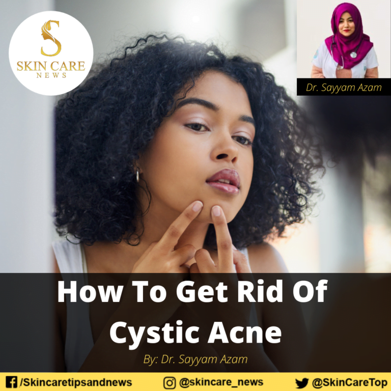 How To Get Rid Of Cystic Acne