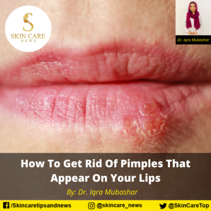 How To Get Rid Of Pimples That Appear On Your Lips
