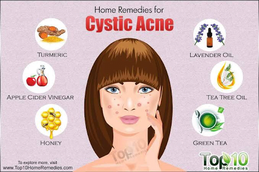 All You Need To Know About Ugly Cystic Acne