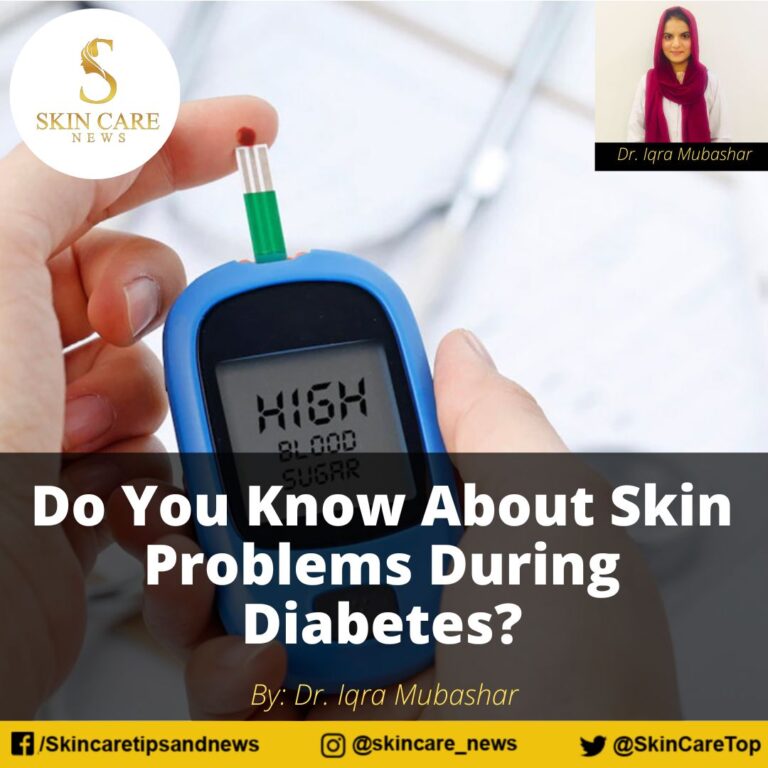 Do You Know About Skin Problems During Diabetes?