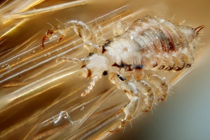 A Guide to Head Lice Treatment