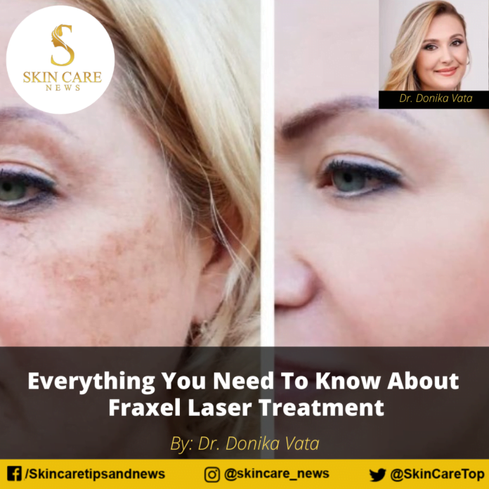 Everything You Need To Know About Fraxel Laser Treatment